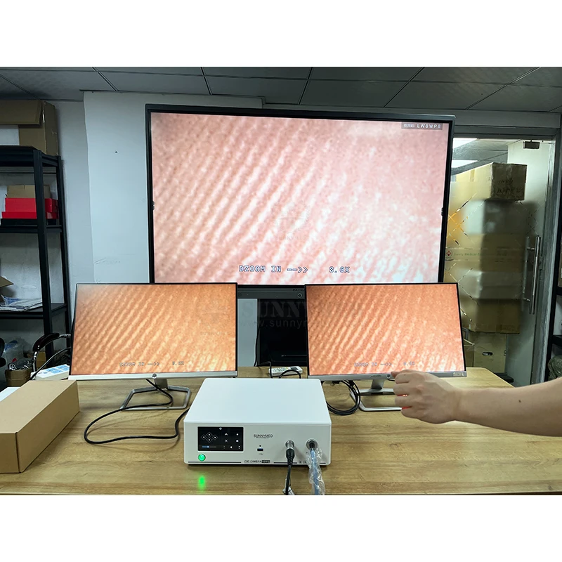 Portable Endoscopy Imaging System For Surgery 4k Medical Camera System ...