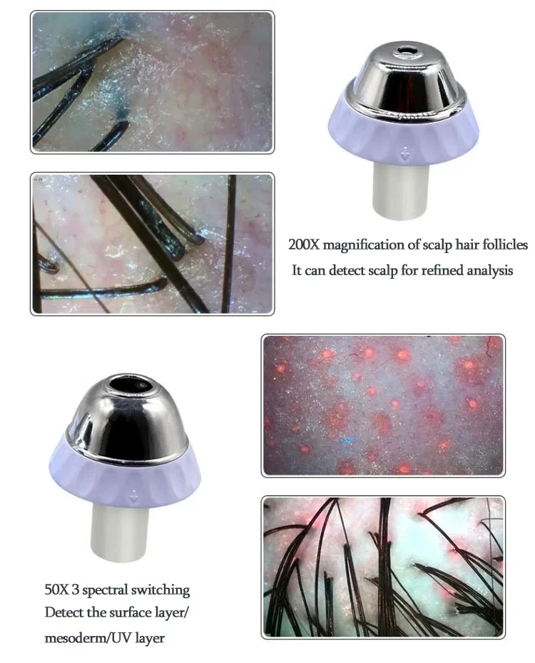 2024 Scalp Scanner Detector Hair Analyzer / Skin And Scalp Hair ...