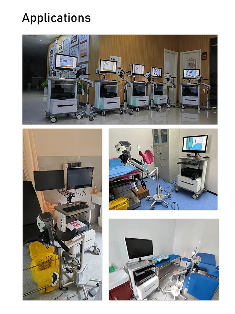 IKEDA Digital Colposcope - High-Definition Gynecology Camera