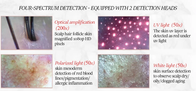 Portable Hair Scalp Scanner / Scalp Hair Follicle Detector Analyzer ...