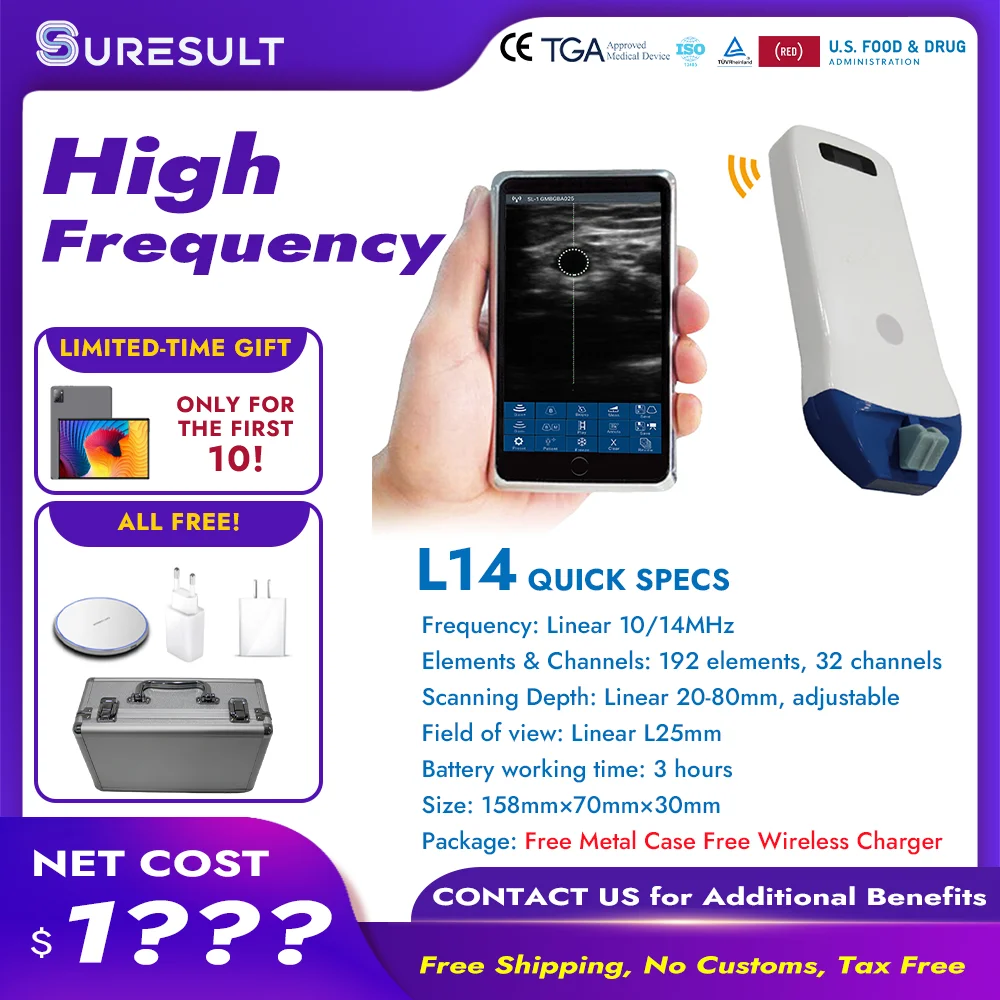 Suresult Beijing Konted's Convex & Transvaginal Probe 3-in-1 Doppler ...