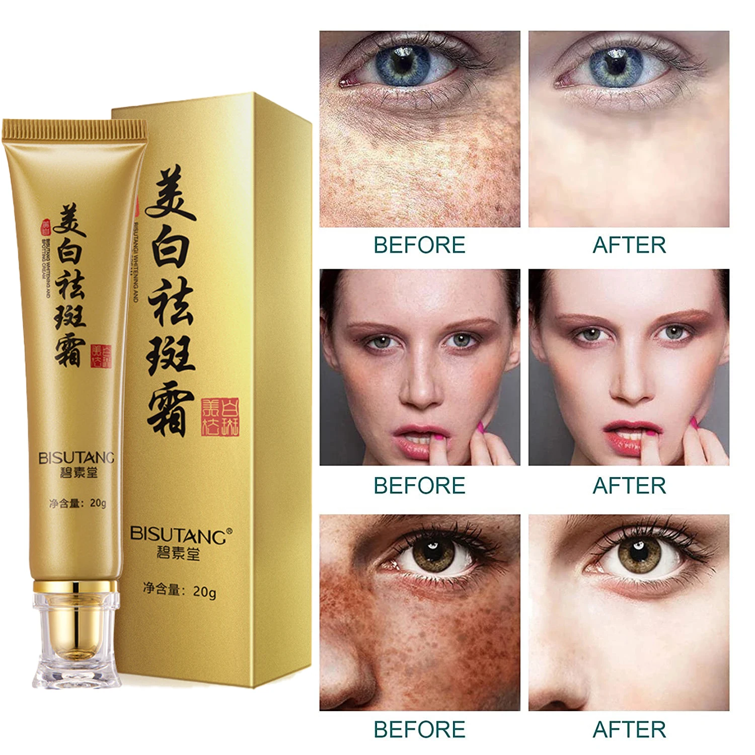 Bisutang Whitening Freckles Cream Remove Melasma Dark Spot Lightening Melanin Removal ...