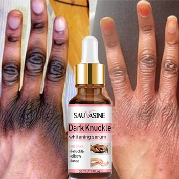 7 Day Dark Knuckles Whitening Pigmentation Serum For Knee Knuckle ...