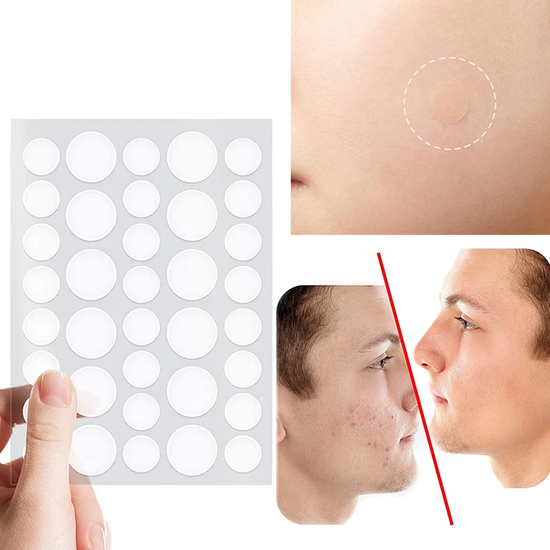Large Circle Small Circle Acne Patch Wholesale Acne Pimple Patch 12dots ...