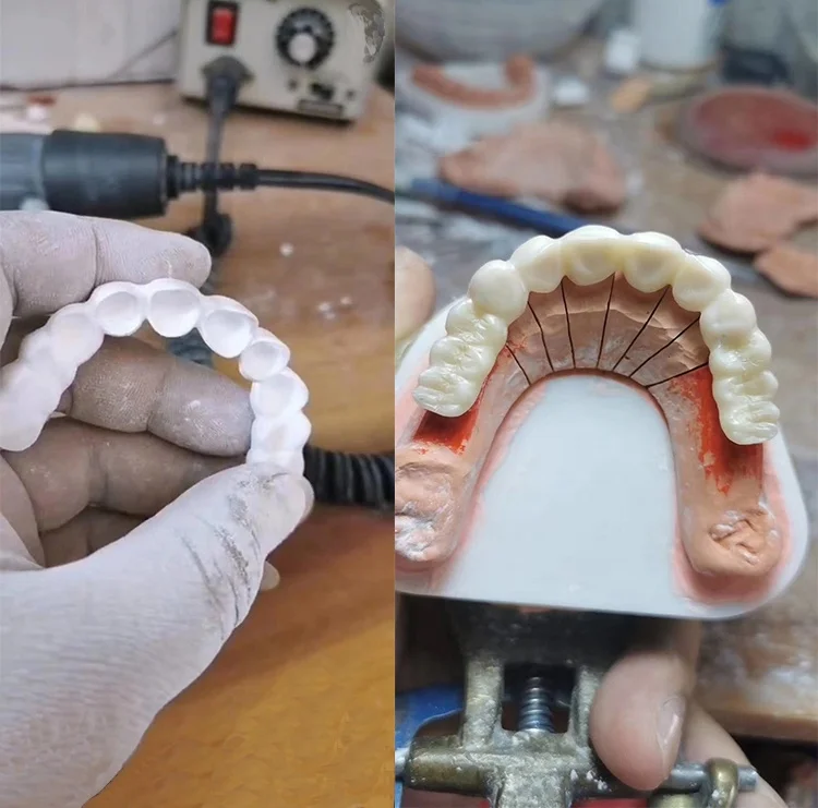 Teeth Equipments Soliconit Sintering Furnace/Sintering Oven/Zirconia ...