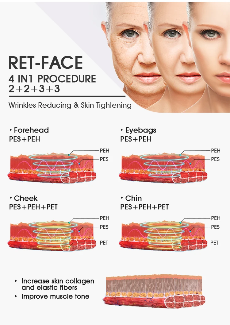 Most Advanced Em Pe Face Rf Ems Sculpting Peface Machine Face Lifting ...