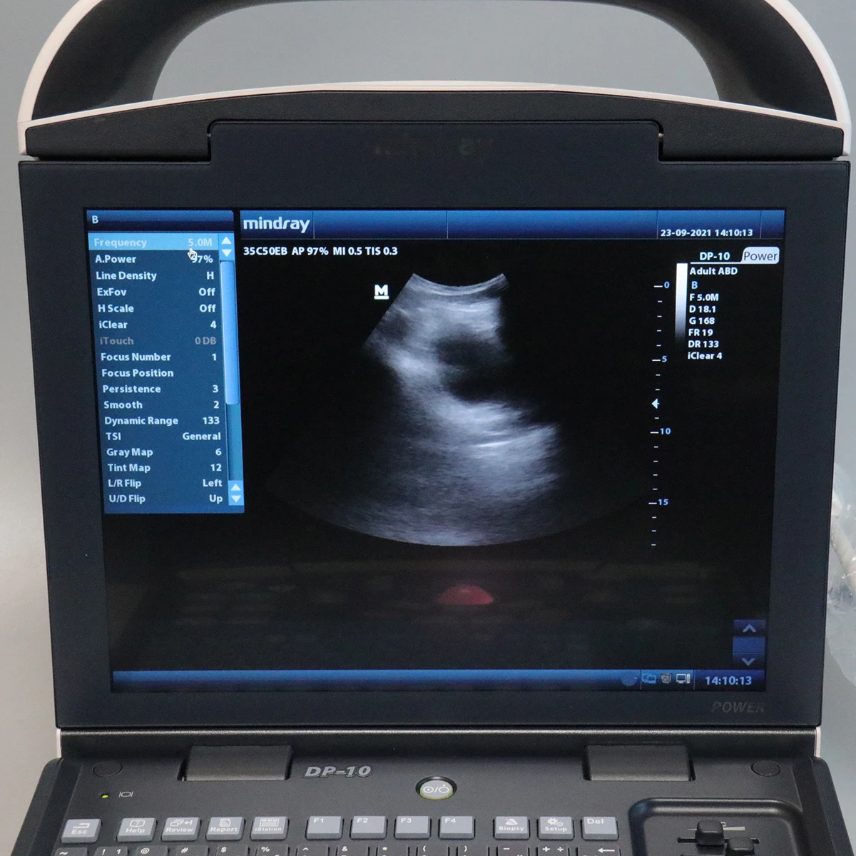 Mindray DP-10 Portable Ultrasound Machine for Diagnostic Imaging - B/W ...