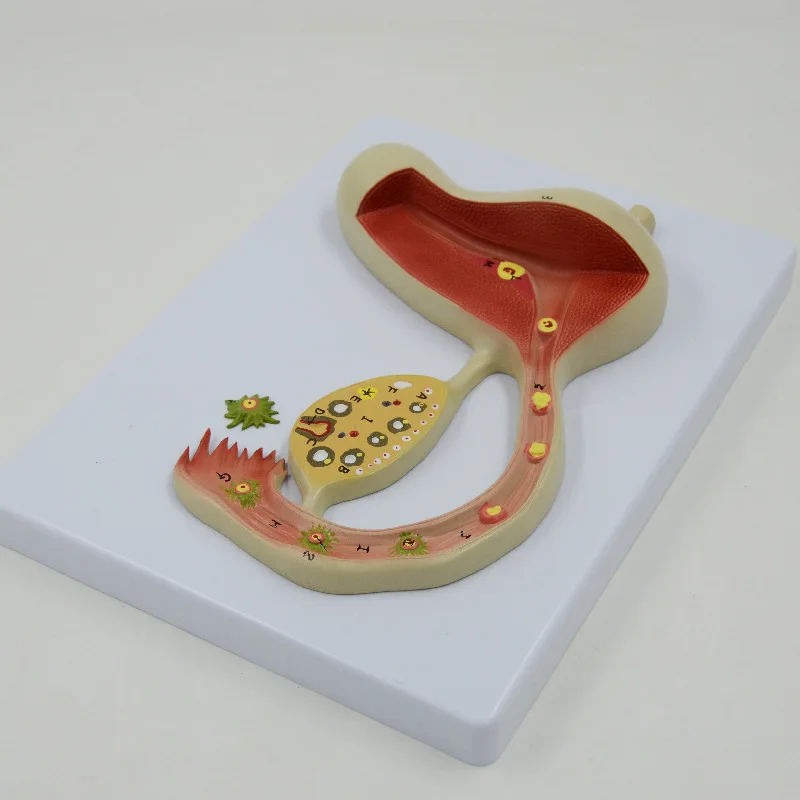 Female Reproductive Fertilized Egg Development Teaching Model Female Reproductive Organs Uterus