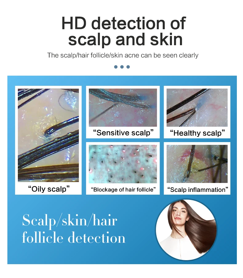 Professional Hd Hair Follicles Scalp Scanner Detector Hair Analyzer ...