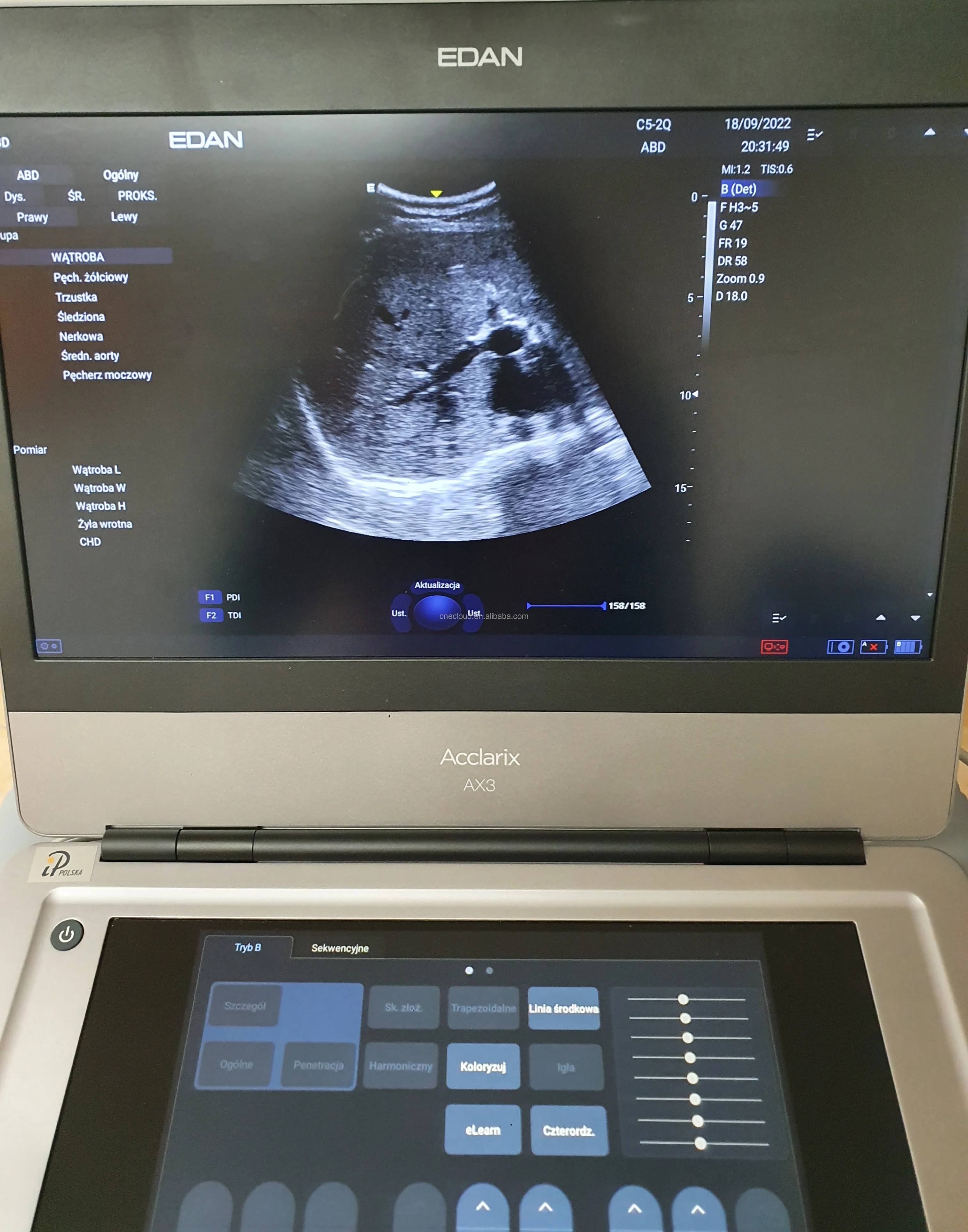 Edan Ultrasound Machines - Reliable and Affordable Solutions