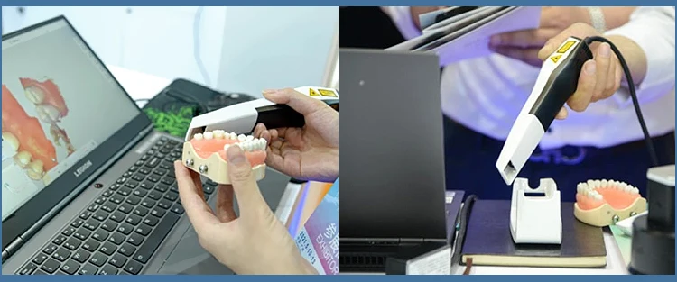 Cheap Price Dental 3d Scanner Intraoral 3 Shape Scanner Intraorale ...