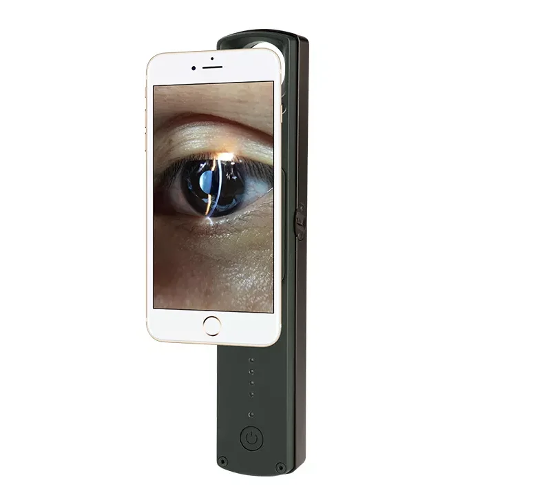 Ophthalmic Optical Microscope Mobile Holder Fundus Camera Adapter ...