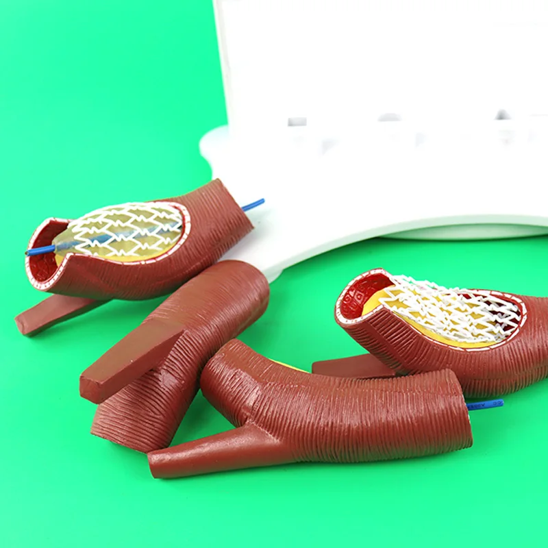 KyrenMed Human Vascular Stent Model Coronary Artery Cardiovascular ...