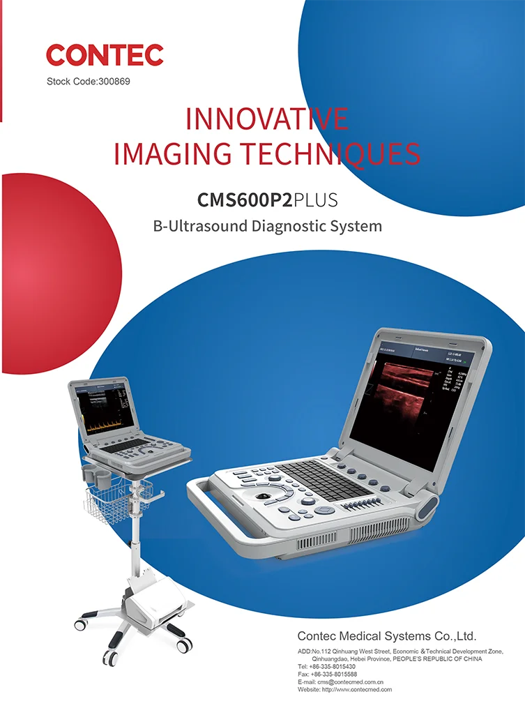 CONTEC Cms600p2plus Portable Doppler for Pulses - 1 Year Warranty