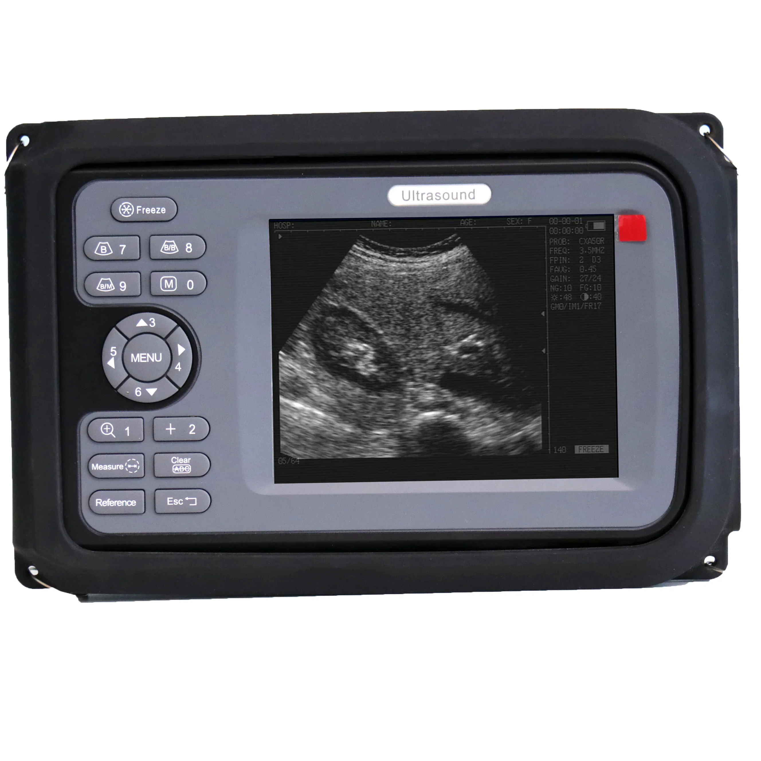 Full Digital Veterinary Ultrasound Scanner/handheld Animal Vet ...