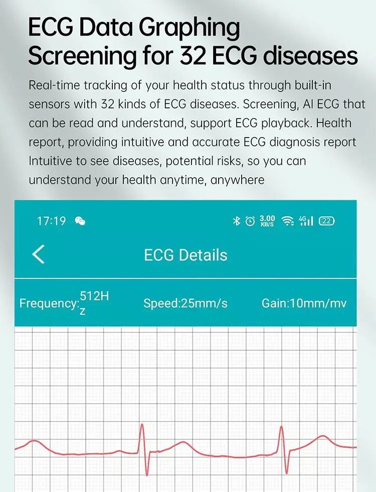 Smart Watch Diabetic Non -invasive Blood Pressure Glucose Test Ecg ...