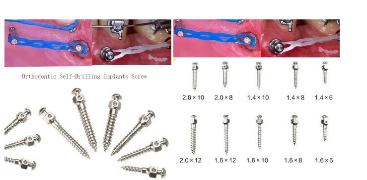 Easyinsmile Dental Material - Orthodontic Implant Micro Mini Screw