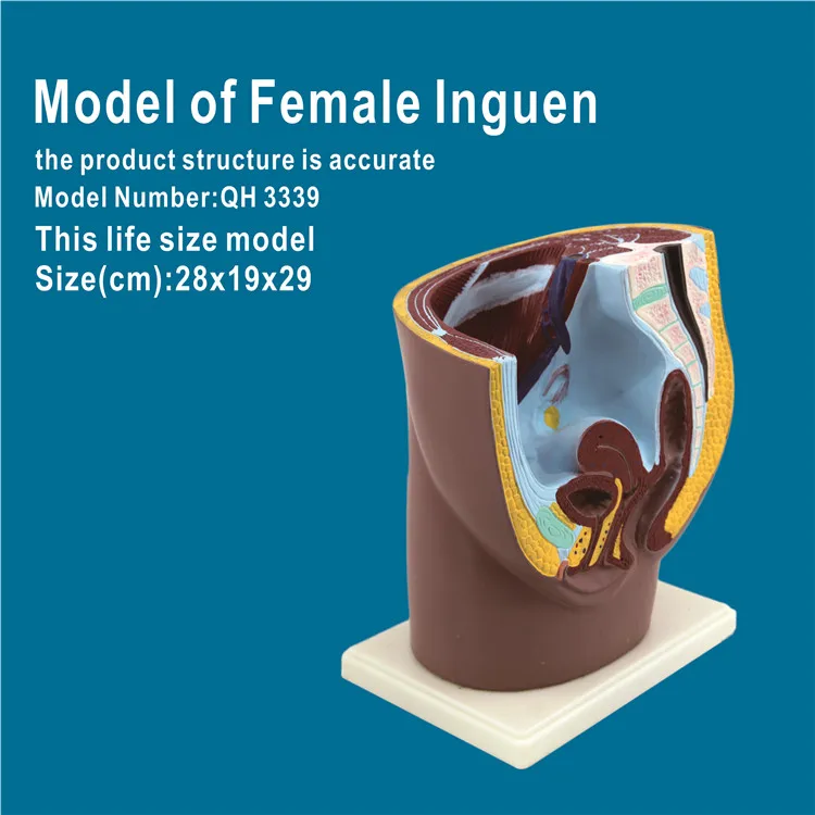 High Quality Anatomy Female Inguen Model - Medical Accuracy