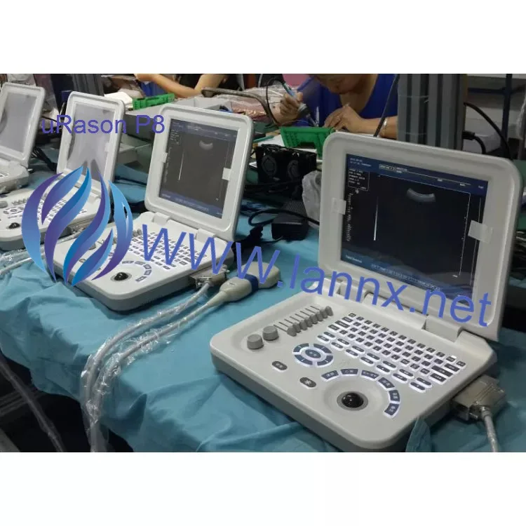 Lannx Urason N20 Medical Ultrasound Diagnostic System Cheapest Color Doppler Portable Ultrasound ...