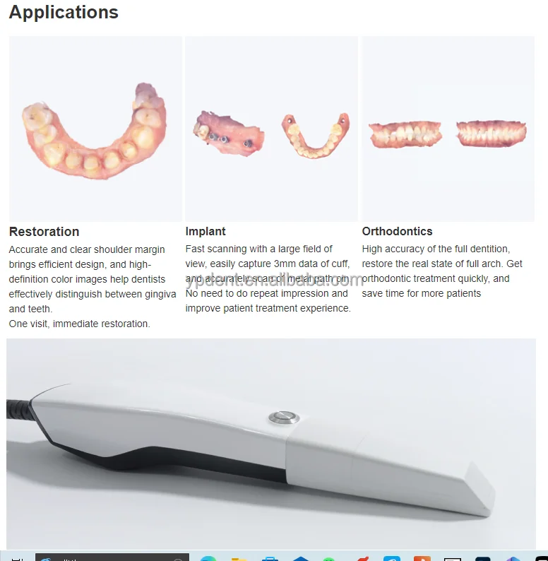 Portable 3d Dental Intraoral Scanner For Dental Lab Scanner Intraoral ...