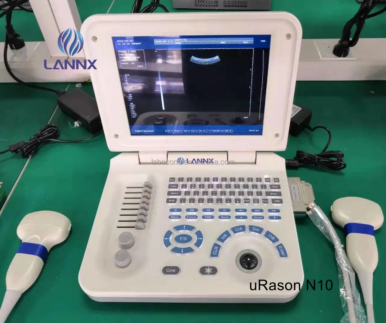 Lannx Urason N10 Well Designed Laptop Ultrasound Machine For Pregnancy Examination B/w ...