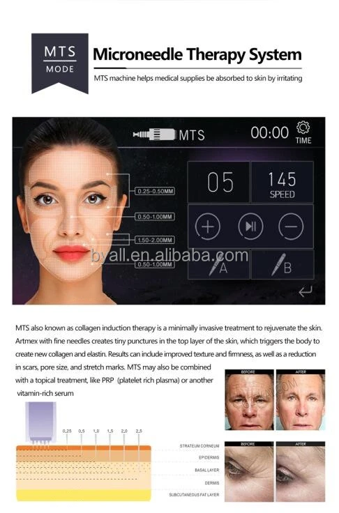 Digital Pmu Mts Permanent Makeup Tattoo Microneedling Machine With 10 ...