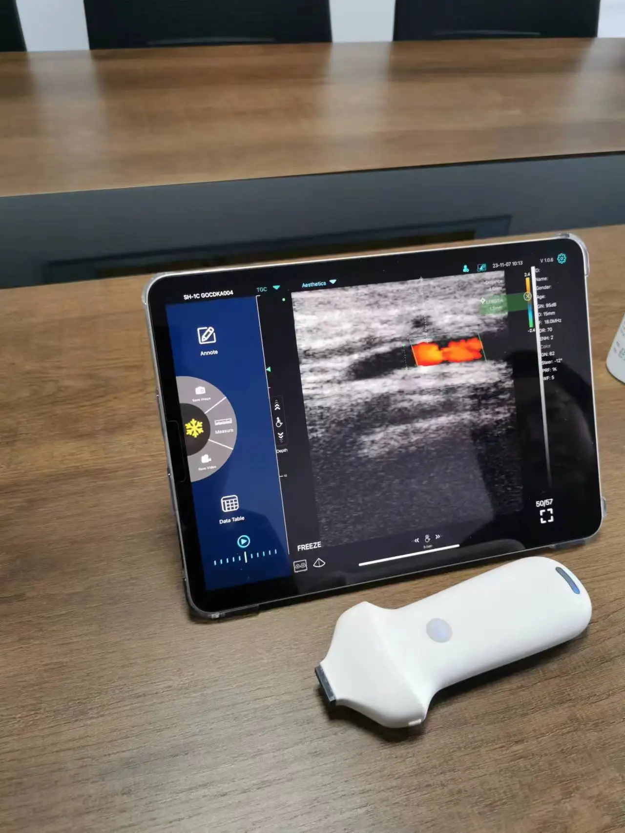 Suresult Electric Color Doppler Obstetric Wireless Ultrasound Monitor ...