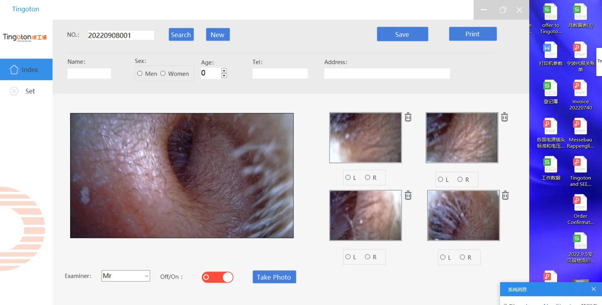 Endostall Visual Otoscope - Advanced Hearing Test Equipment