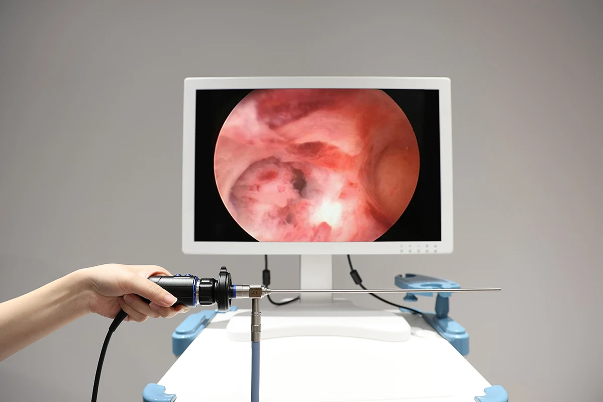 Rigid Cystoscopy Endoscope Set - Urology Surgical Instruments