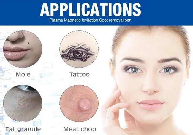 Multifunctional Nevus Wrinkle Pigment Removal Jet Plasma Pen Face Lift ...