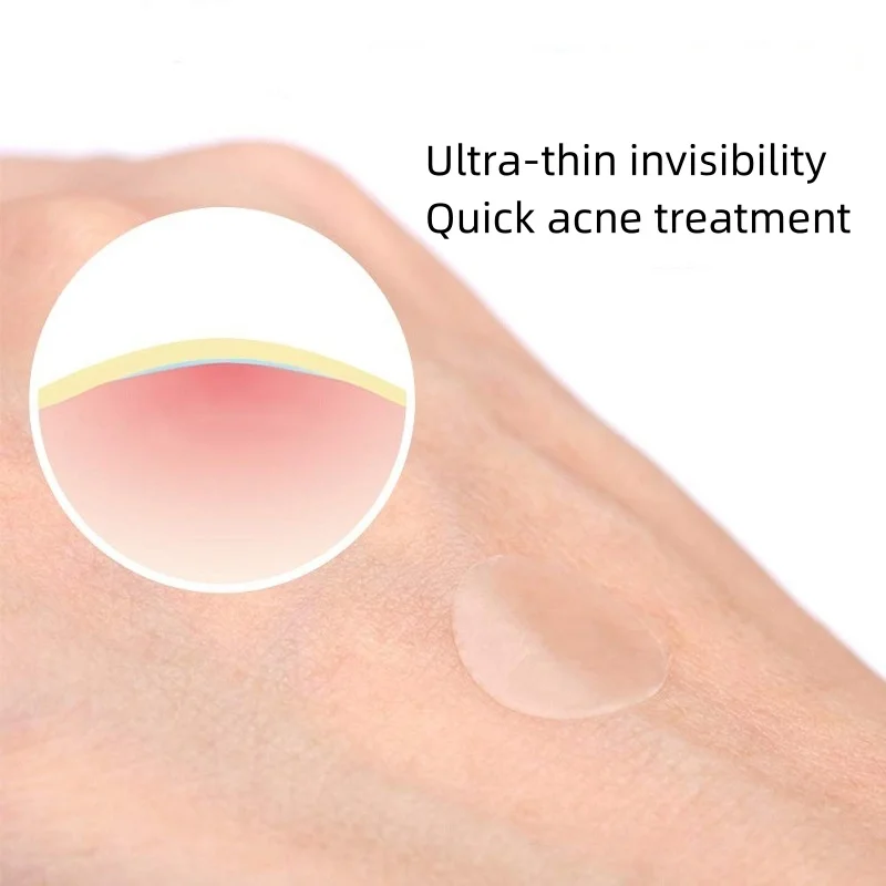 Oem Dispoble Hyalironic And Salicylic Acid Anti-pimple Patches - The ...