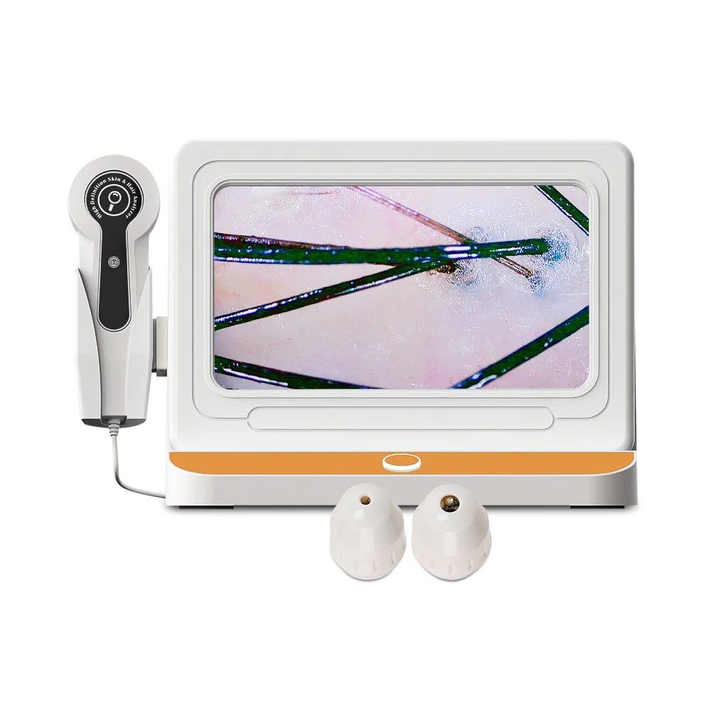 Portable HD Hair Follicles Scalp Scanner Detector Hair Analyzer / Skin ...