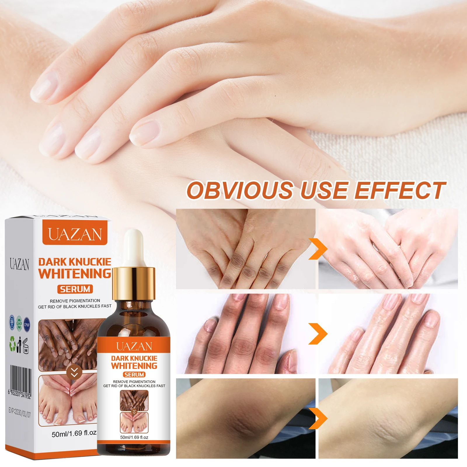 Dark Knuckles Fast Whitening Serum – Pigmentation Corrector for Hands ...