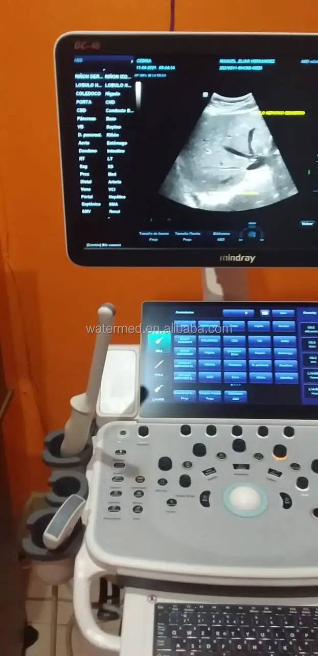 Available Mindray 4D Ultrasound DC-40 Mindray Trolley| Alibaba.com
