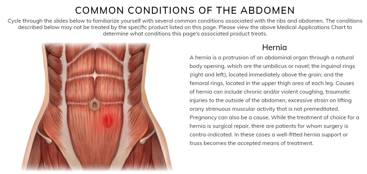 Abdominal Strain Belt - Post Surgical & Rib Fracture Support