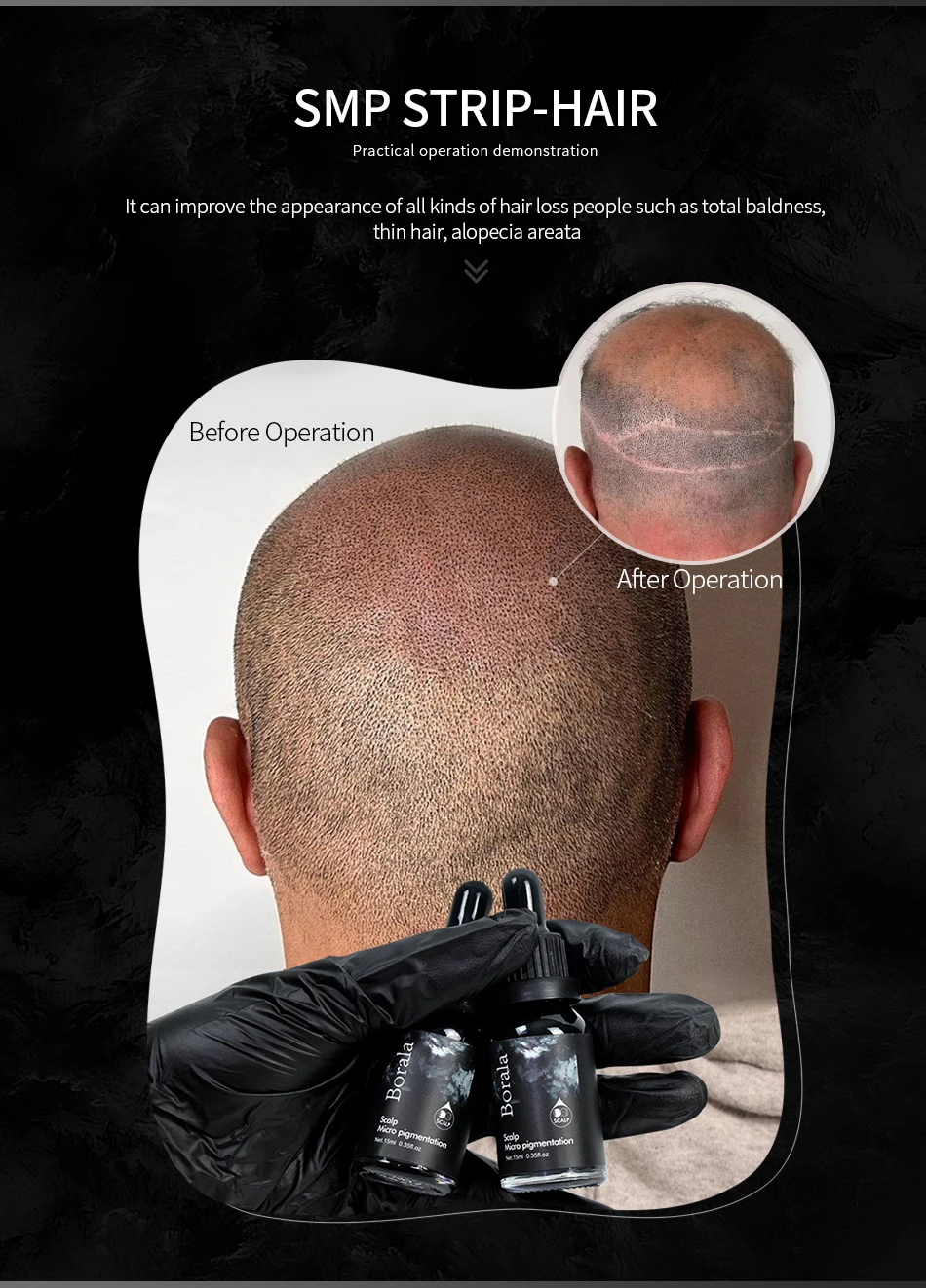 Smp Semi Permanent Makeup Follicle Micropigmentation Pigment For Scalp ...