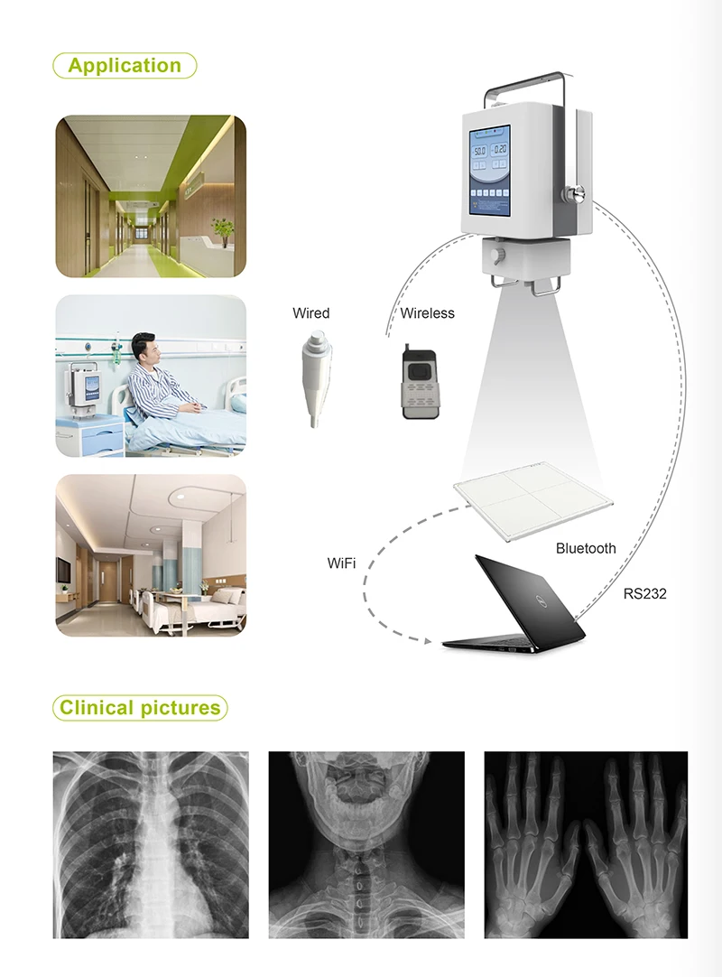 Iray Digital X Ray Machine Price - Medical Radiology Equipment