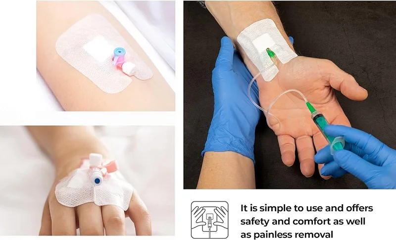 Breathable Iv Catheter Fixation Dressing Non Woven I.v. Cannula ...