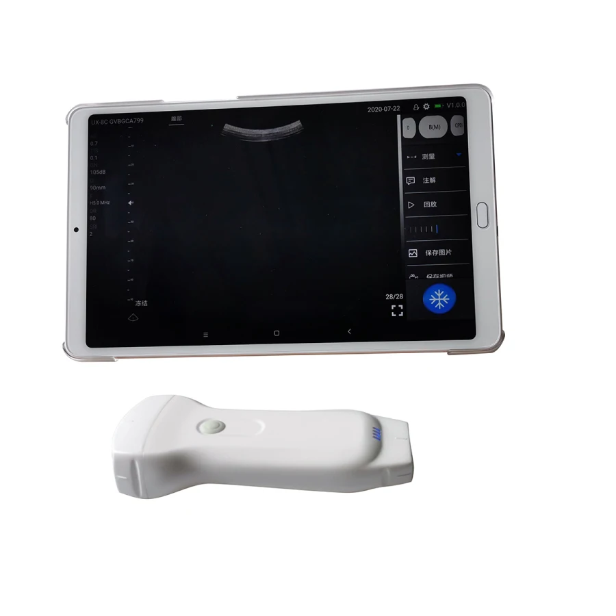 Highest Cost-Effective Double Probes Wireless Color Doppler Ultrasound ...