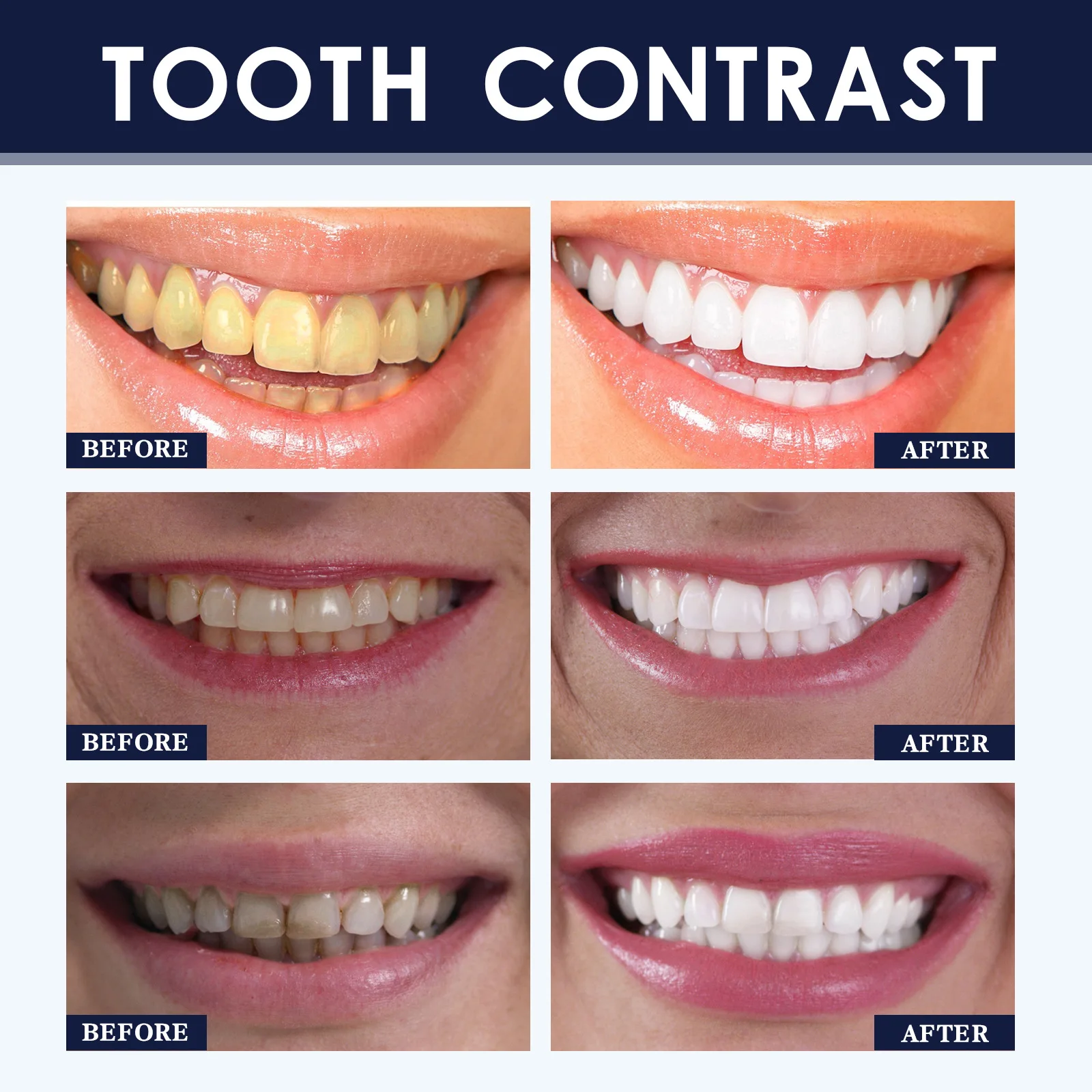 Wholesale Best Selling Professional Dental Custom Brand Tooth Powder ...