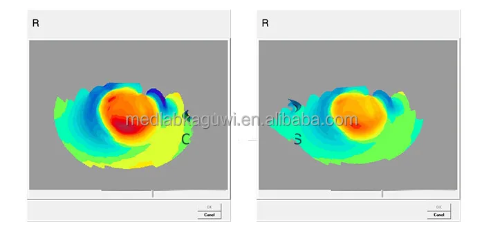 Corneal Topographer - Precision in Optometry & Ophthalmology