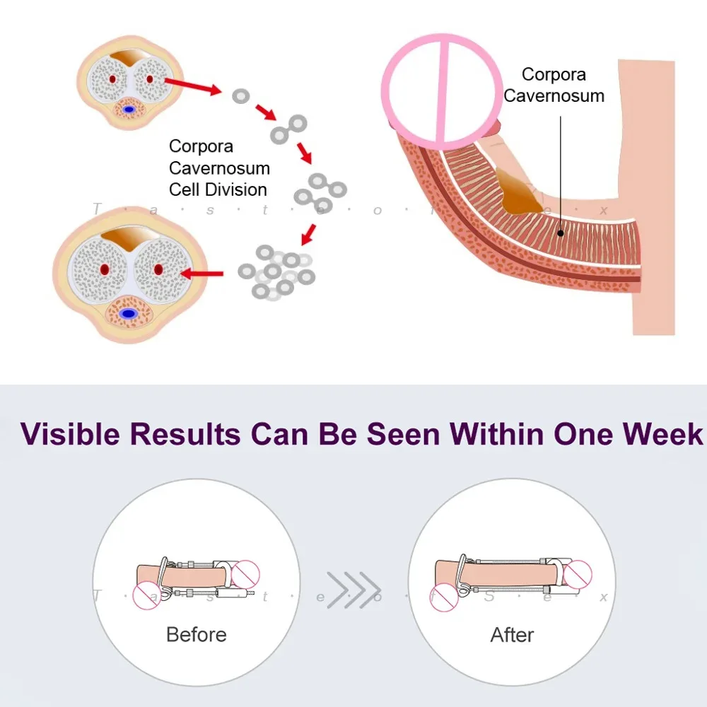 Easymax Penis 24K - Advanced Enlargement & Straightening