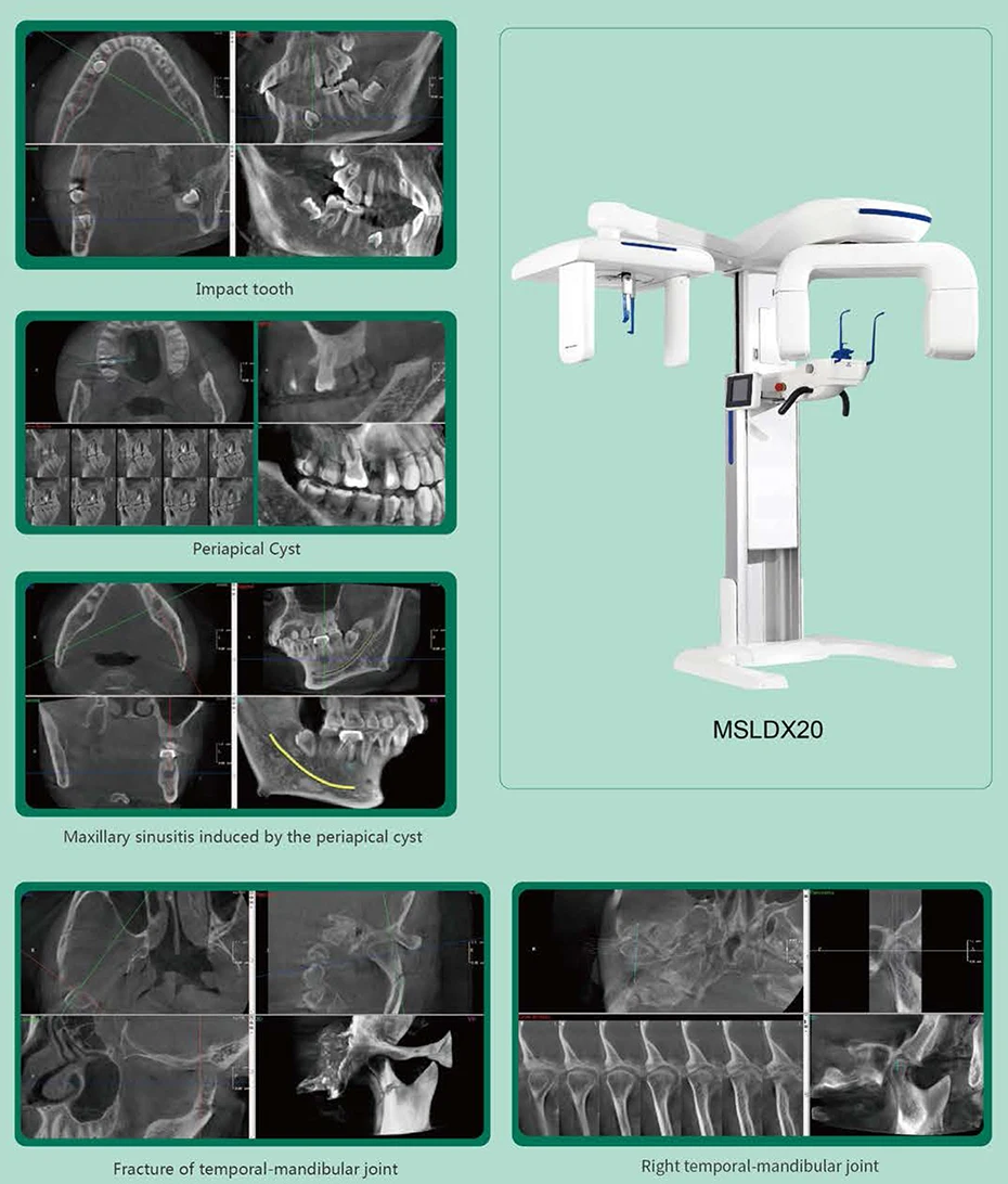 Dental Instruments - MSLDX20 Digital CBCT 3D OPG X Ray Scanner