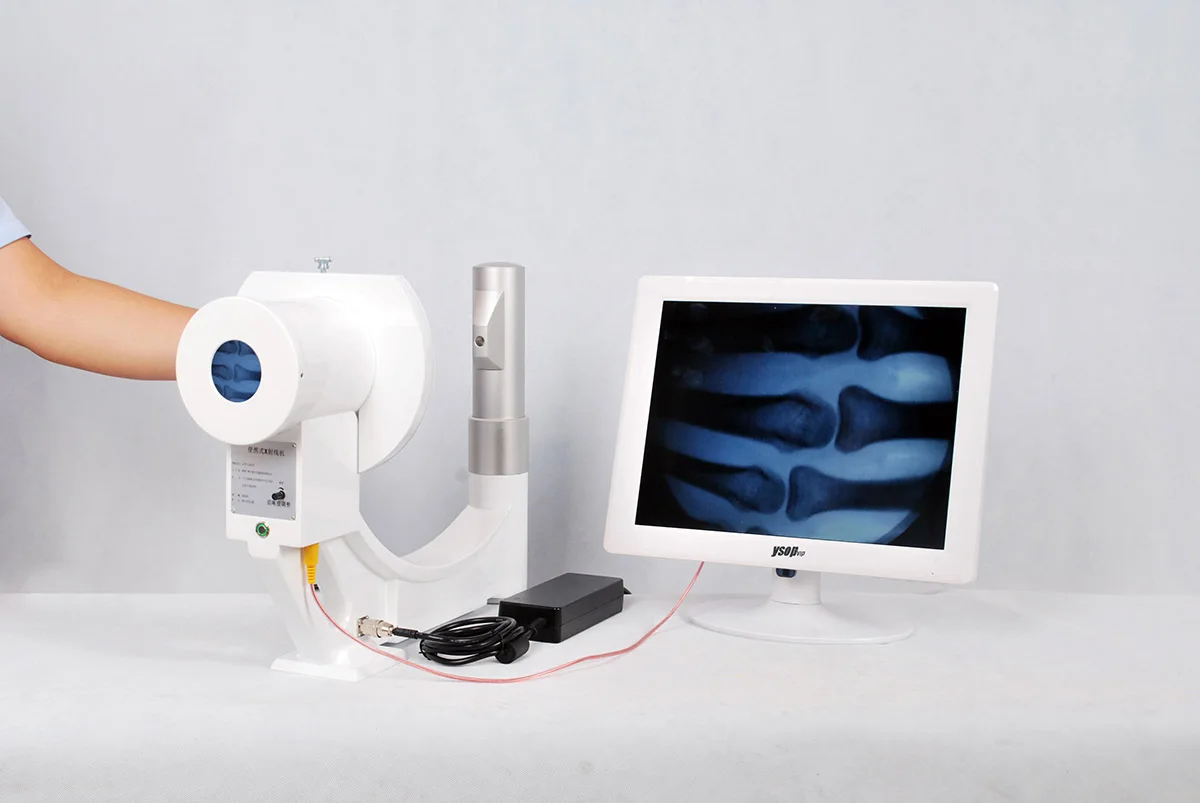 Medical Portable Digital Fluoroscopy X-ray Machine For Orthopedic - Buy ...