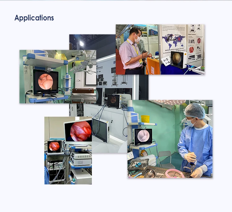 SD FHD Medical Endoscopic Camera System for ENT Surgery