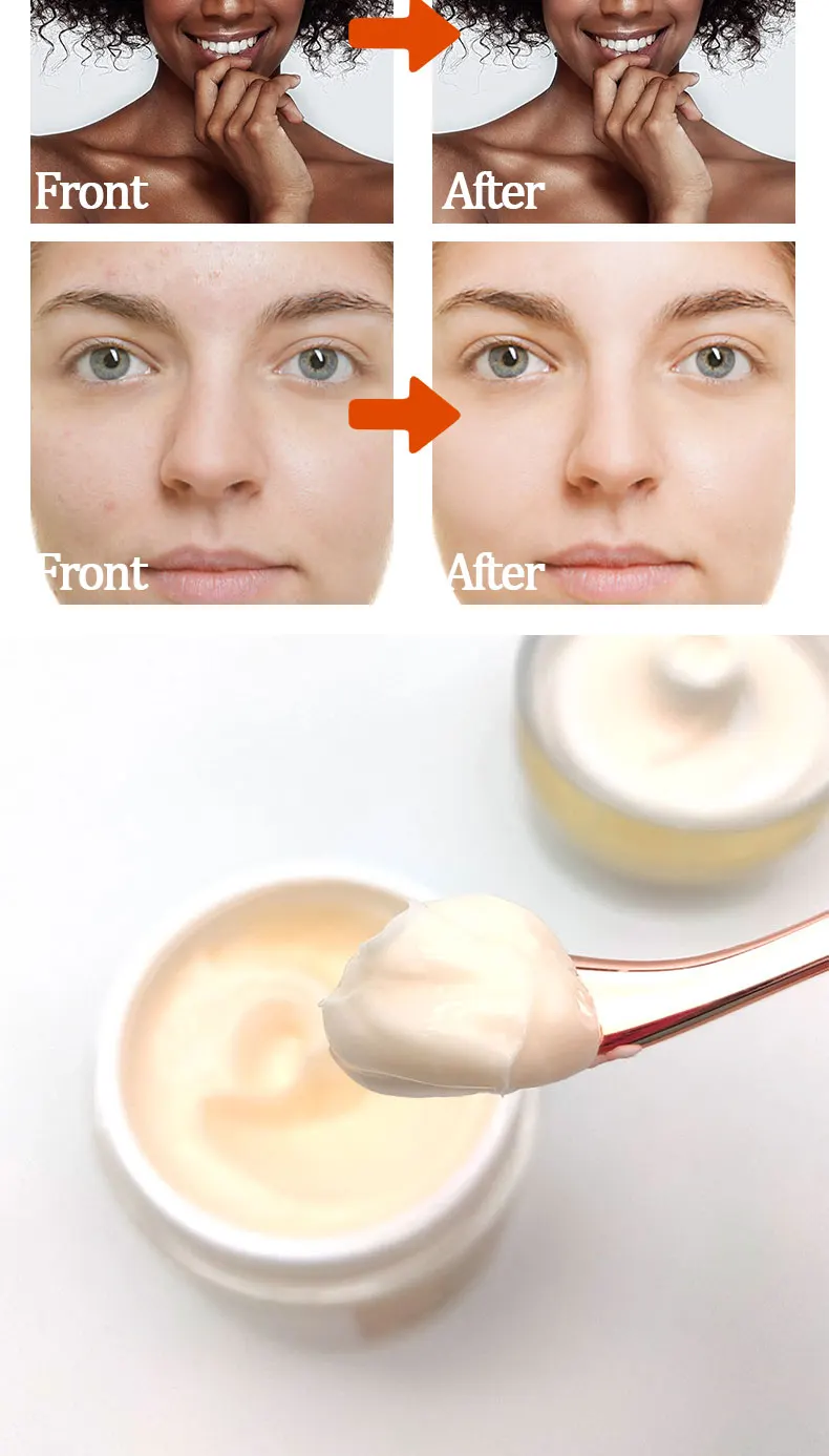 OEM Carotone Organic Whitening Cream for Face & Body - Anti-Aging ...