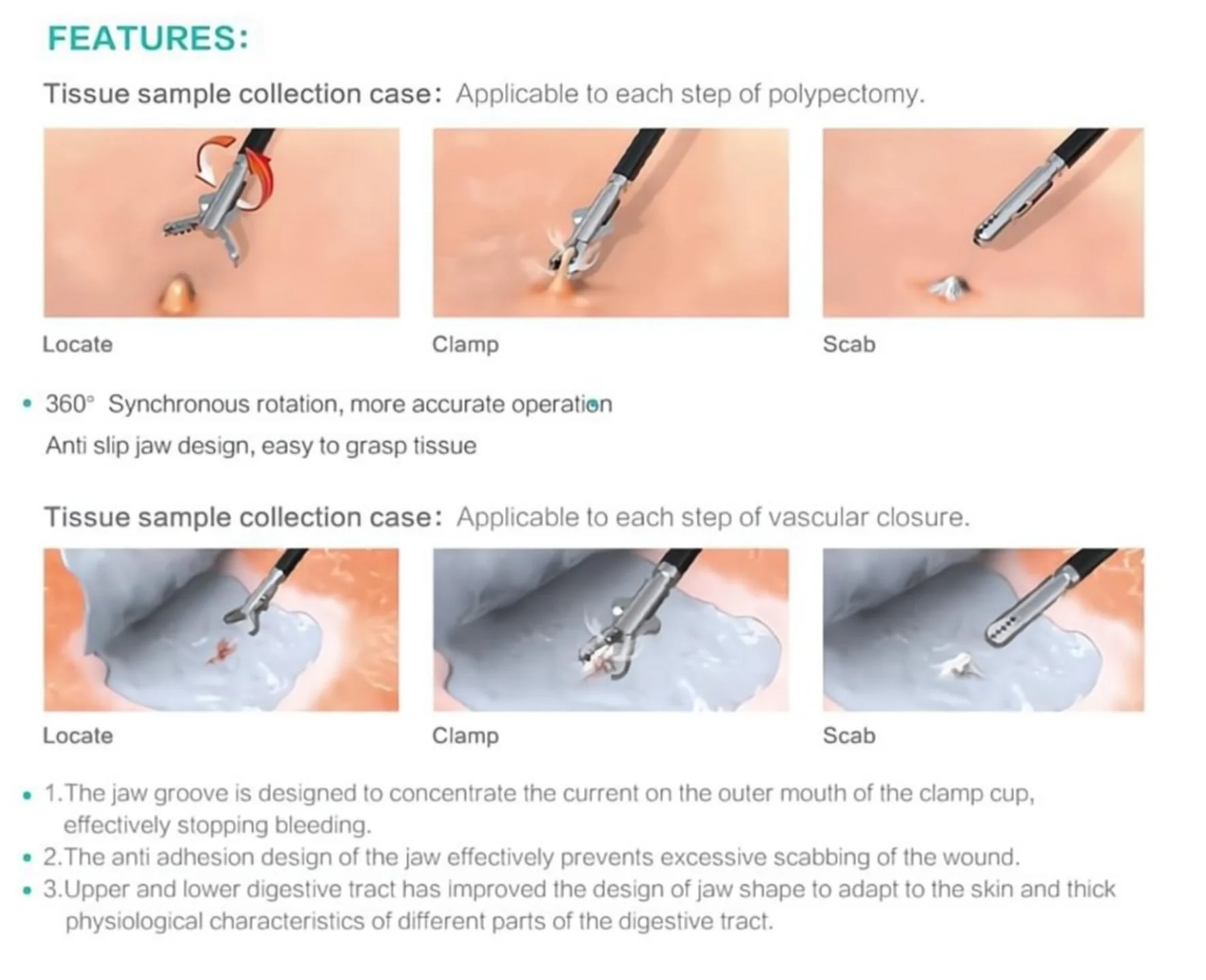 Single Use Colonoscopy Biopsy Forceps Endoscopy Gastric Biopsy Forceps ...