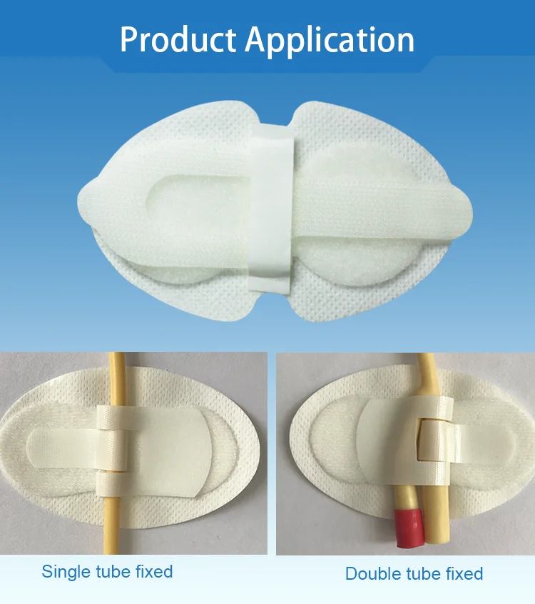 Surgical Patients Medical Catheter Fixation Patch One-time Catheter ...