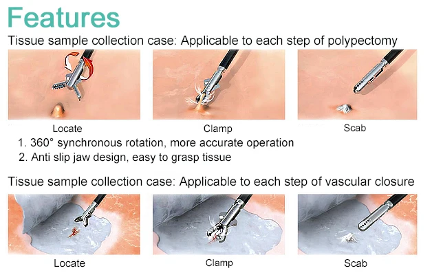 Disposable Hot Biopsy Forceps Ethylene Oxide Disinfection 360 Degrees ...