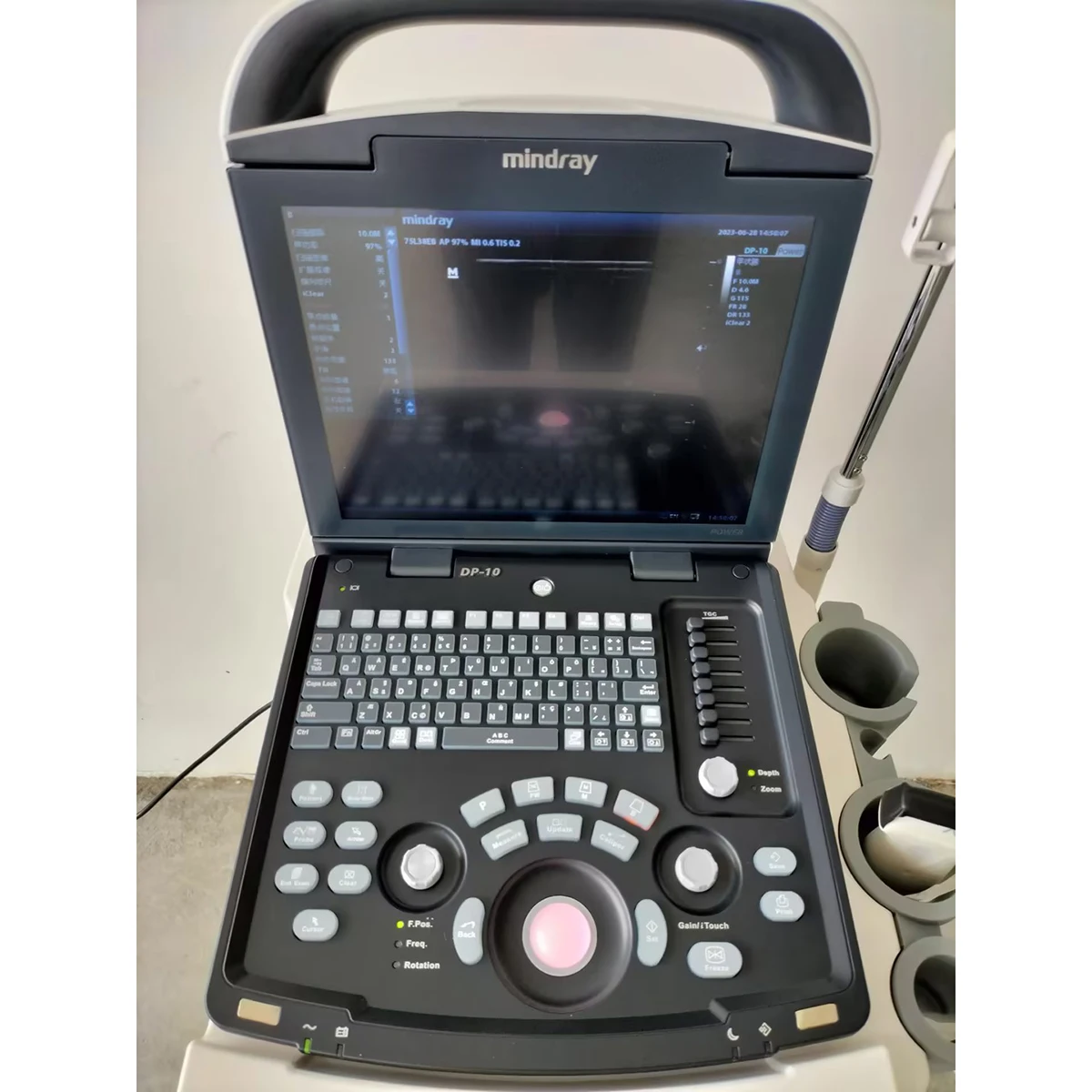 Mindray DP 10 Ultrasound Machine - Portable & Versatile